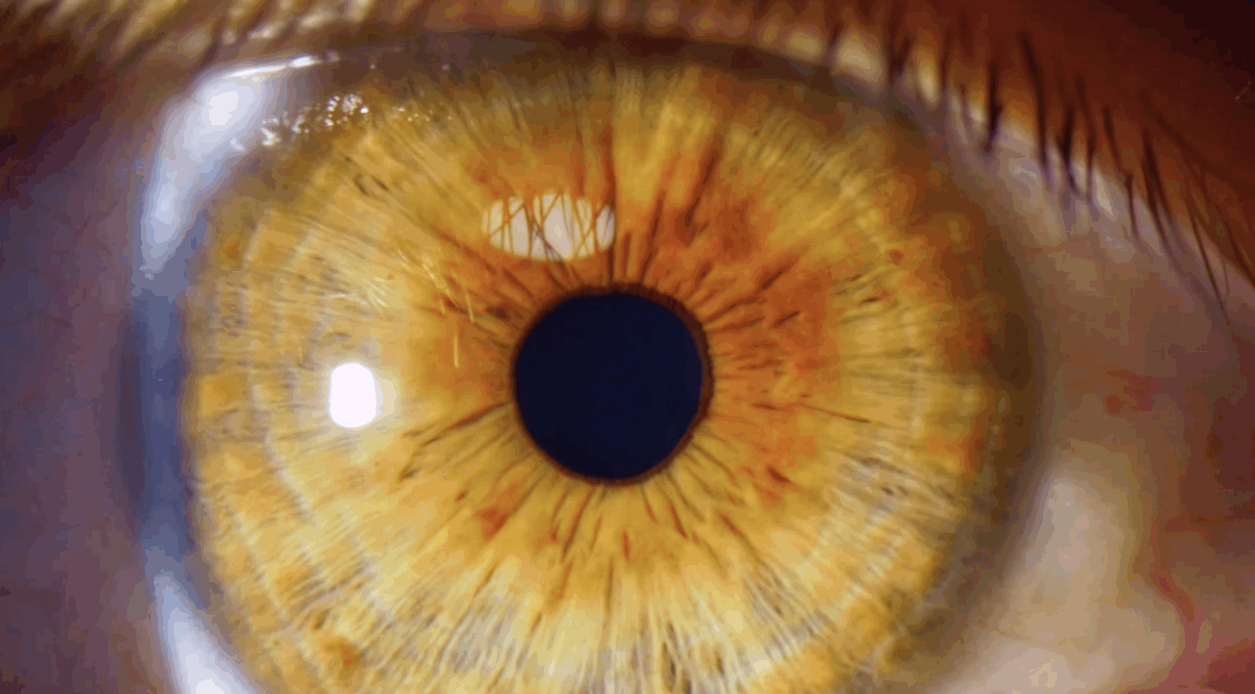 Transforming Patient Care with Streets Heaver and OCL Vision | So ...